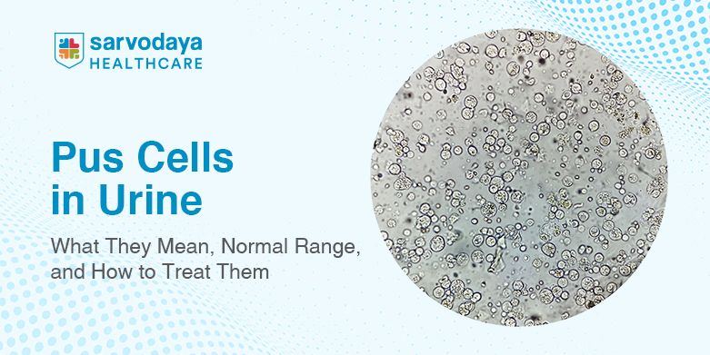 microscope examination pus cells